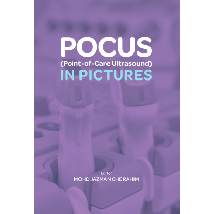 POCUS (Point-of-Care Ultrasound) In Pictures